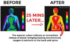 My Back Pain Coach Review